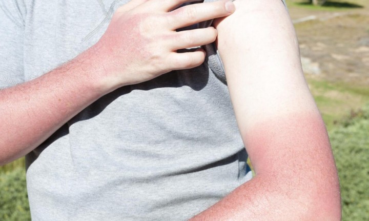 Tak Perlu Keluarin Biaya Mahal, Ini 3 Cara Alami Memutihkan Tangan ...