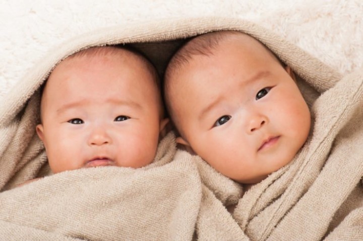 Bayi Kembar Siam: Gejala, Penyebab dan Cara Penanganannya | RIAU24.COM