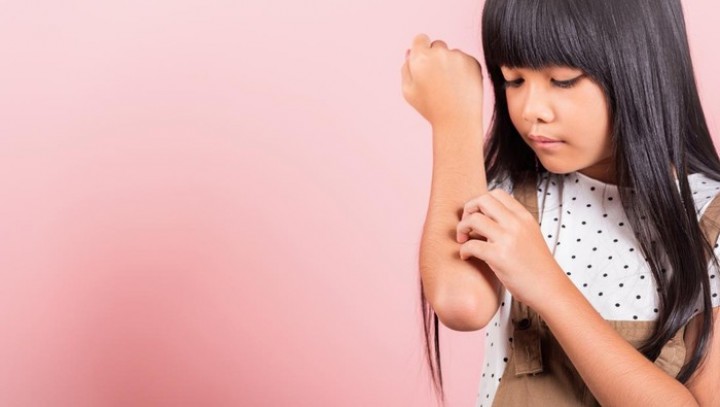 Ini Penyebab Scabies pada Manusia, Ciri-ciri, dan Cara Mengobatinya ...