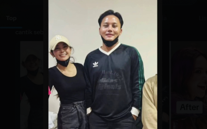 Rizky Febian dan Mahalini Dikritik Gegara Lakukan Operasi Plastik ...