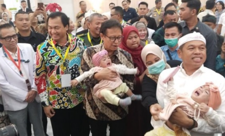 Kisah Bayi Nadia dan Nadira, Kembar Siam asal Tasikmalaya yang Sukses Dipisahkan | RIAU24.COM