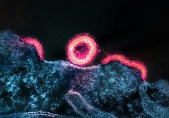 Para Ilmuwan Hidupkan Kembali Virus Purba Berusia 40.000 Tahun dengan ...